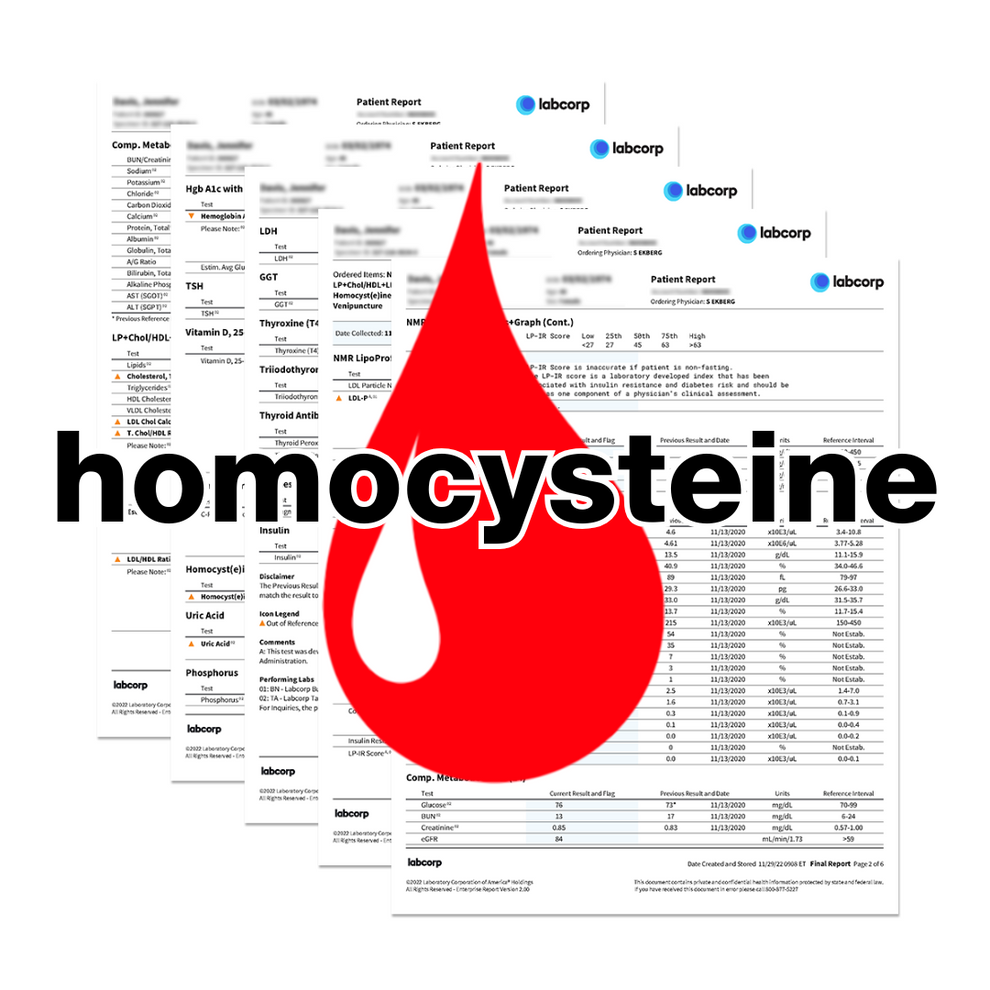 Blood Test / Blood Work - Homocysteine Lab Work in USA – DrEkberg.Shop